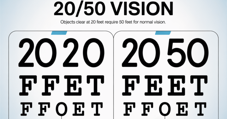 20/50 Vision: Meaning, Causes, and How to Improve It - Digitalquil ...